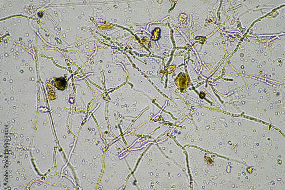 soil fungi under the microscope, soil microbes organisms in a soil and ...