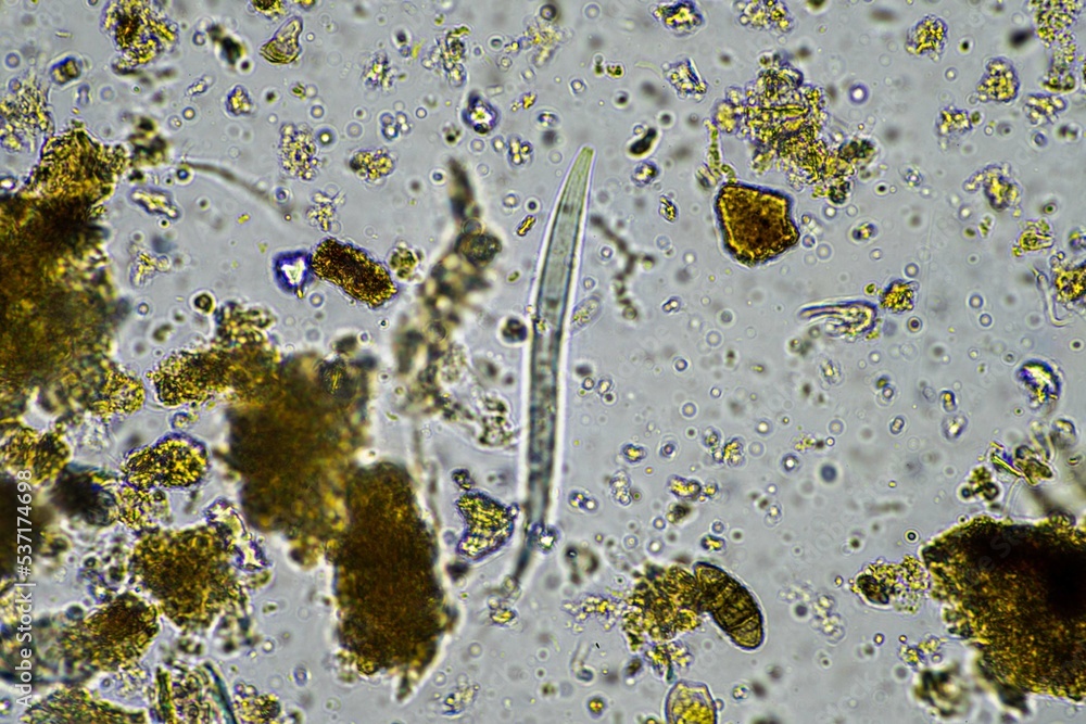 soil fungi under the microscope, soil microbes organisms in a soil and ...