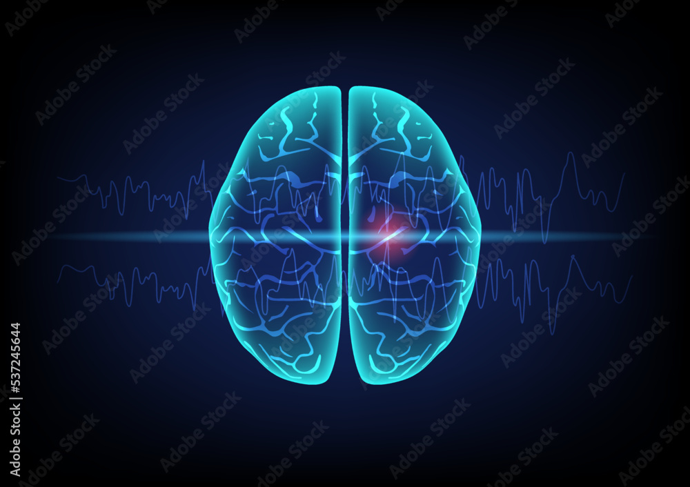 Illustration of human brain and brain waves on technology background ...
