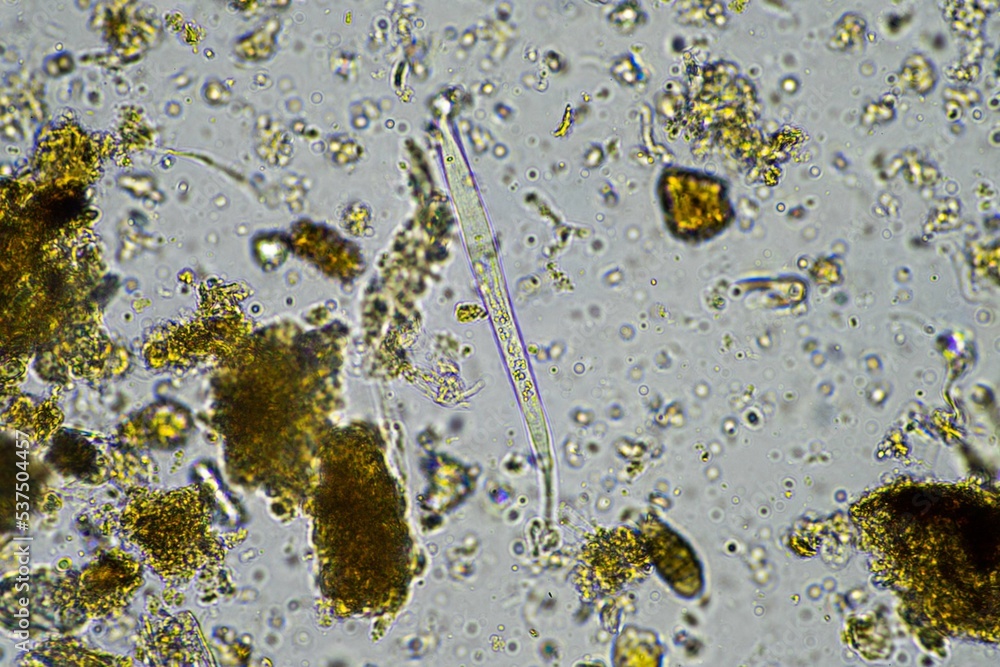 microorganisms and soil biology, with nematodes and fungi under the ...
