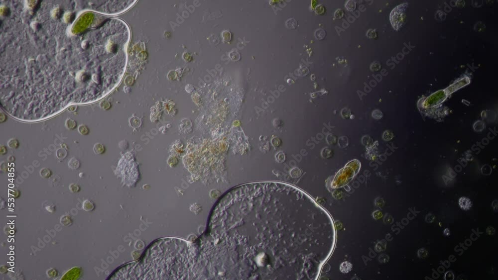 Amoeba and many other microorganisms in the frame. Also in the frame ...