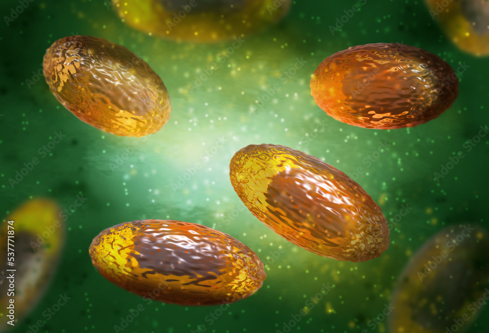 Septicemic Plague Pictures
