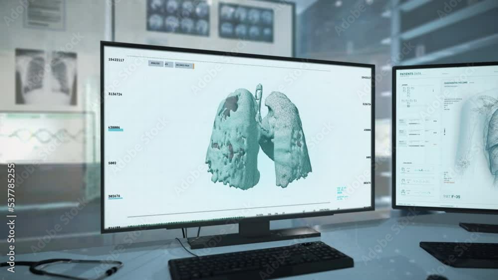Vidéo Stock Digital lung analysis tech is used at the modern health ...