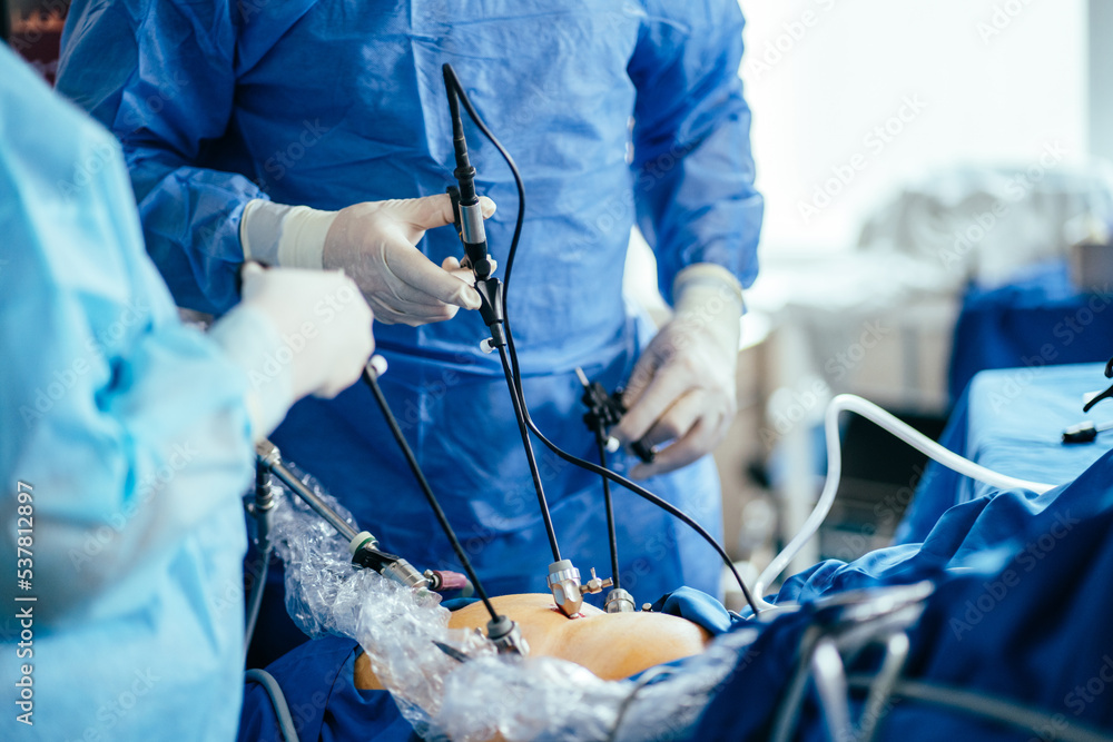 Procedure in the operating room of the hospital. Medical probes stuck ...