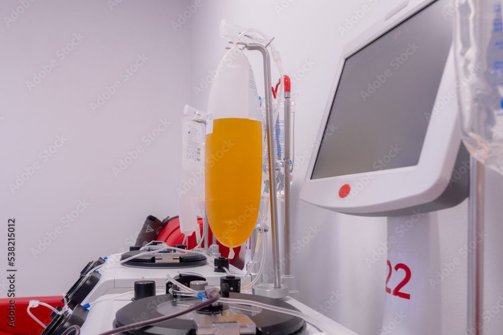 A bag of blood plasma hangin on a device for plasma separation. Nurse ...