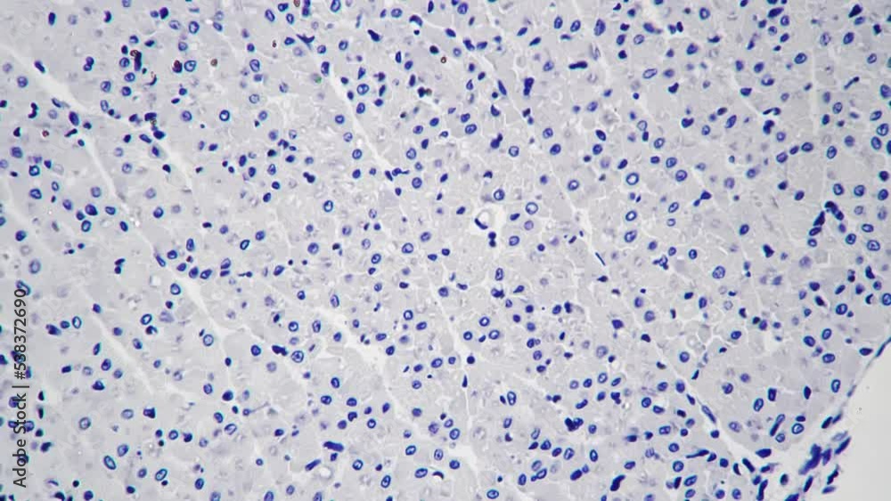 Microscope 400x of cardiac muscle in section filmed on bright field ...