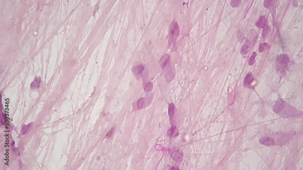 Loose connective tissue whole mount microscopic view with 400 times ...