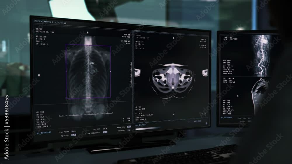 Radiology scanner diagnosing the patient at the clinic. Radiology ...