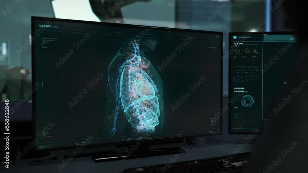 Scanning the patients chest for the analysis of the heart ...