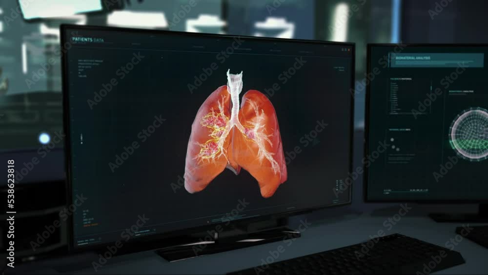 Diagnostic scanner is analyzing the virtual lungs for infection ...