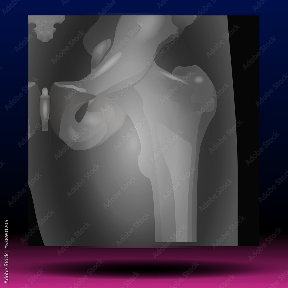 X-Ray of Deformities - Fla source file available - Film X-ray of ...