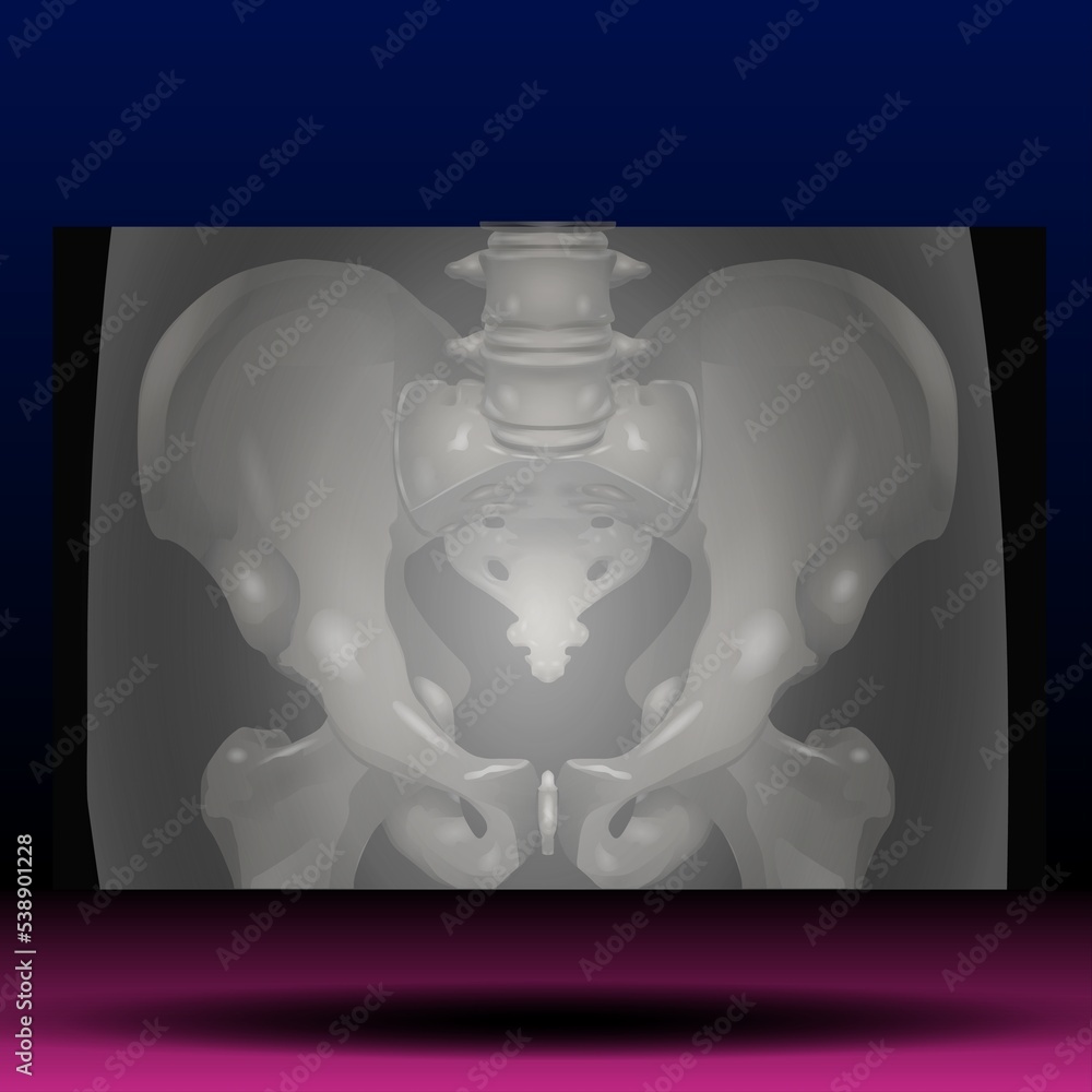 X-Ray of Pelvis - Fla source file available - Structure of the pelvis ...