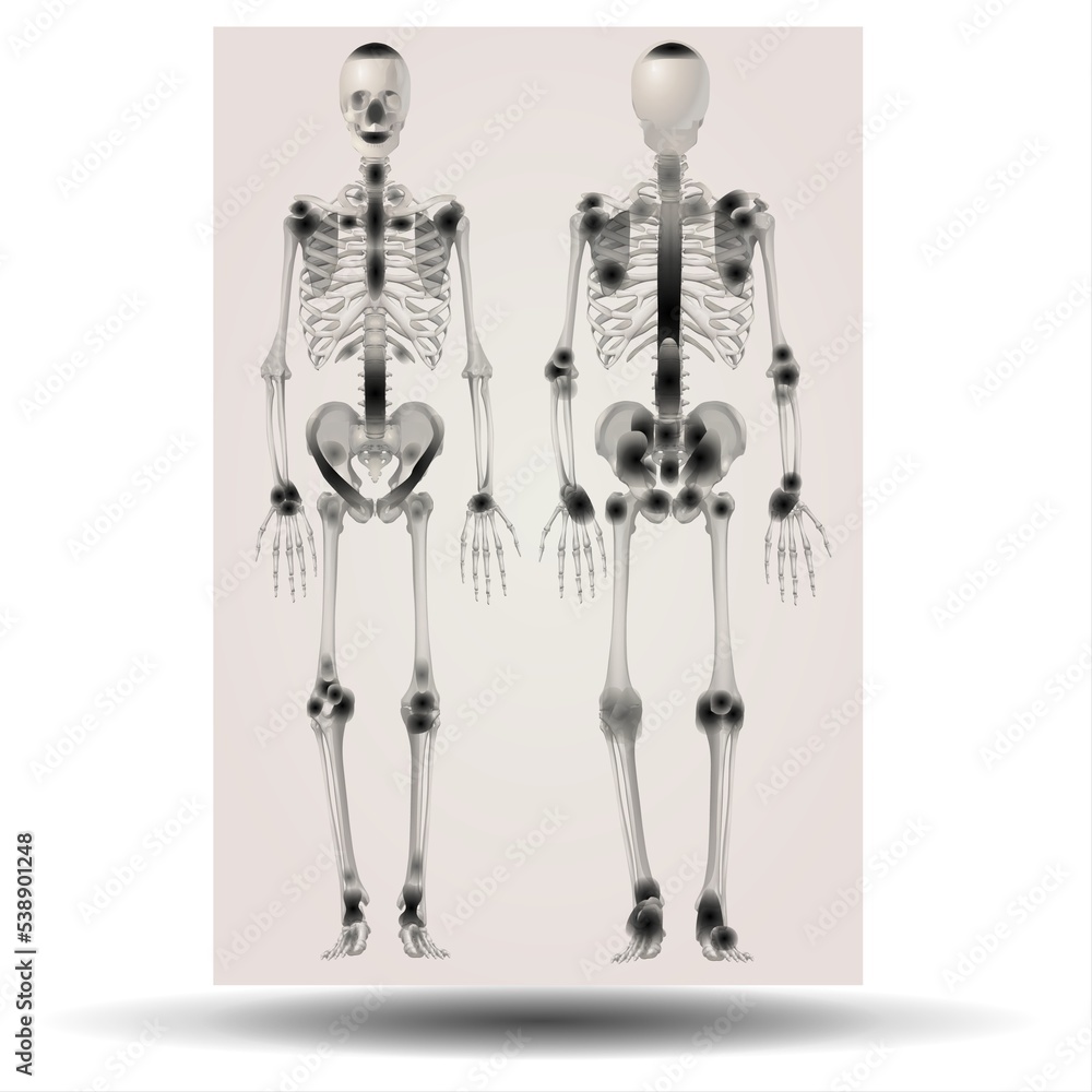 X-ray illustration of a human skeleton - Fla source file available - X ...