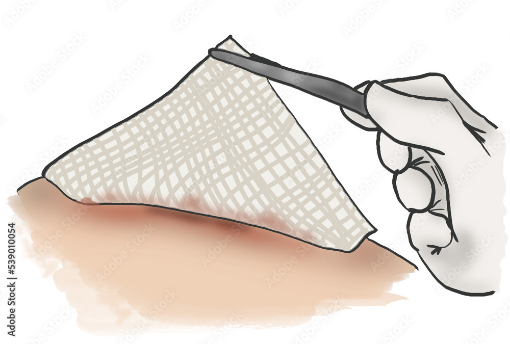 Wound care nursing clipart of bandage dressing change in comic style on ...