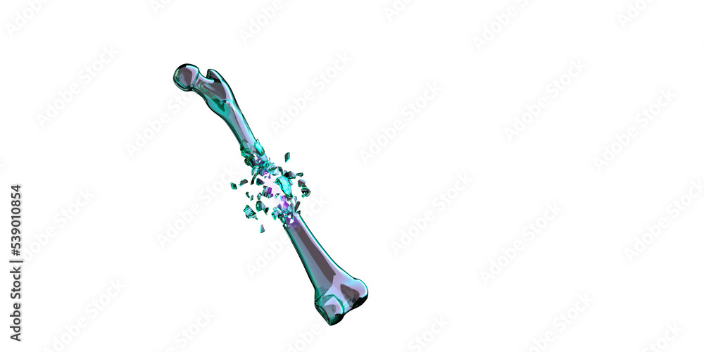 Glass transparent glossy human fractured broken bone on transparent ...