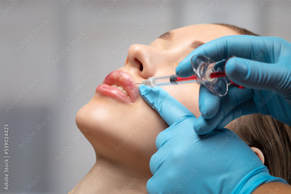 Injections for lips augmentation anti wrinkle injections on the face of ...