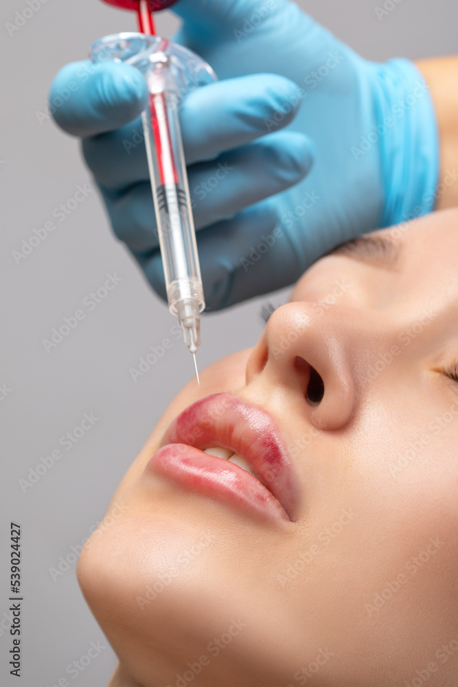 Injections for lips augmentation anti wrinkle injections on the face of ...