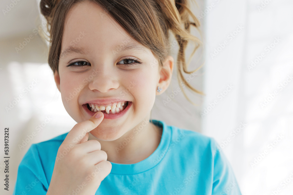The child has lost a tooth. Little girl without a tooth. The first ...