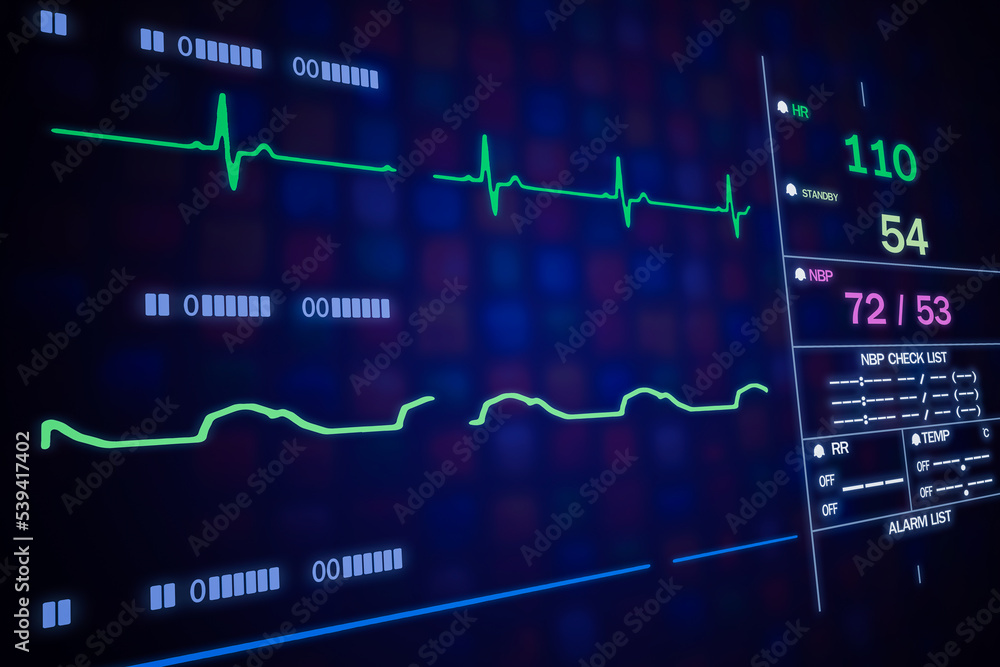 Poster Patient monitor showing vital signs ECG and EKG. – Muurposter ...