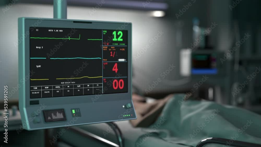 Monitoring Heartbeat Of Patient In Clinic By Using ECG Machine Display ...