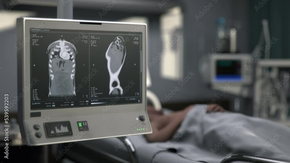 Organ diagnostic imaging system examining the emergency patient in a ...