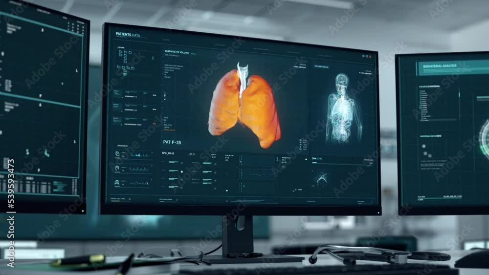 Vidéo Stock X-ray is used for the diagnostic of the patients illness at ...