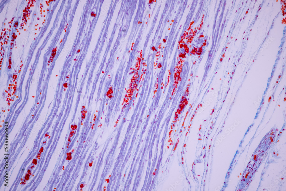 Hyaline cartilage, Elastic cartilage and Bone Human under the ...