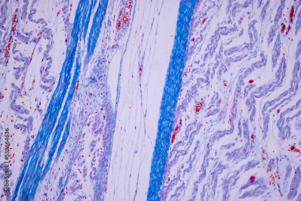 Hyaline cartilage, Elastic cartilage and Bone Human under the ...