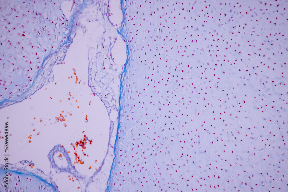 Hyaline cartilage, Elastic cartilage and Bone Human under the ...