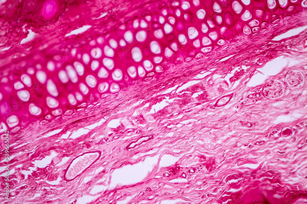 Hyaline cartilage, Elastic cartilage and Bone Human under the ...