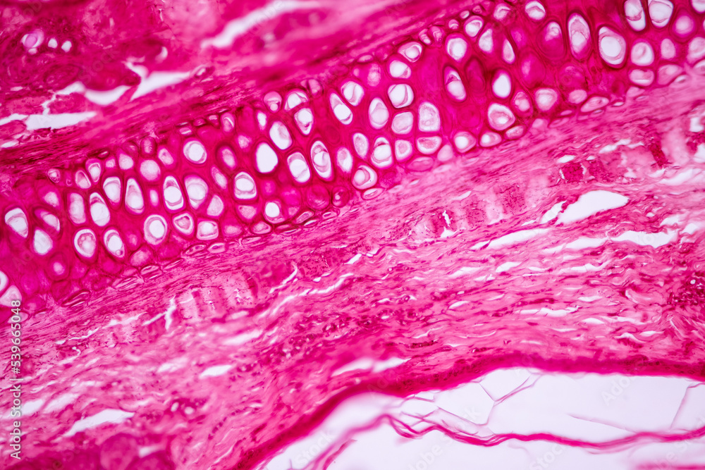 Hyaline cartilage, Elastic cartilage and Bone Human under the ...