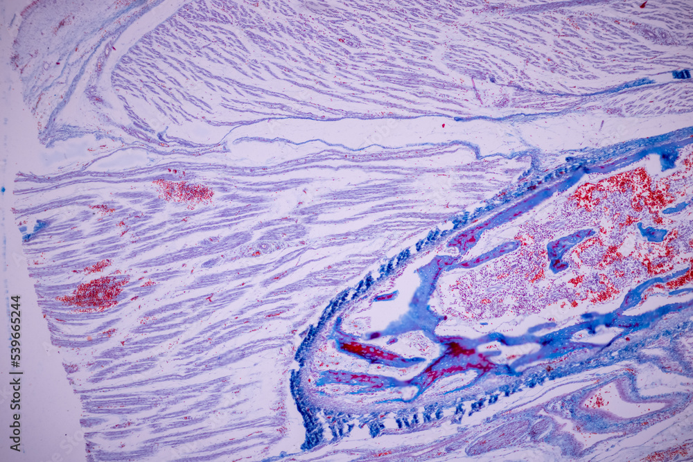 Hyaline cartilage, Elastic cartilage and Bone Human under the ...