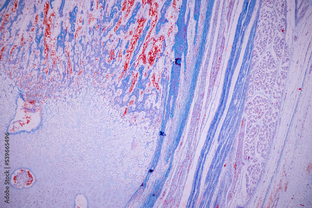 Hyaline cartilage, Elastic cartilage and Bone Human under the ...