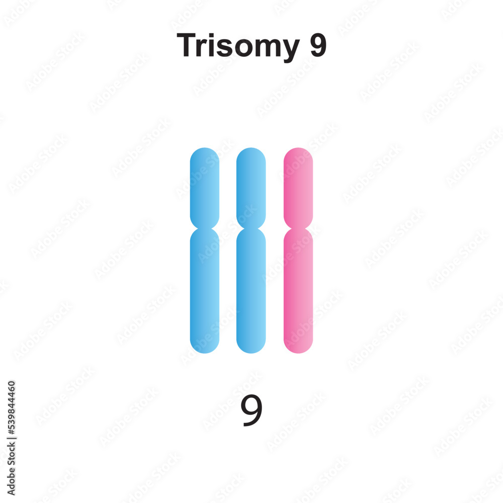 Scientific Designing of Trisomy 9. Colorful Symbols. Vector ... Scientific Designing of Trisomy 9. Colorful Symbols. Vector ...