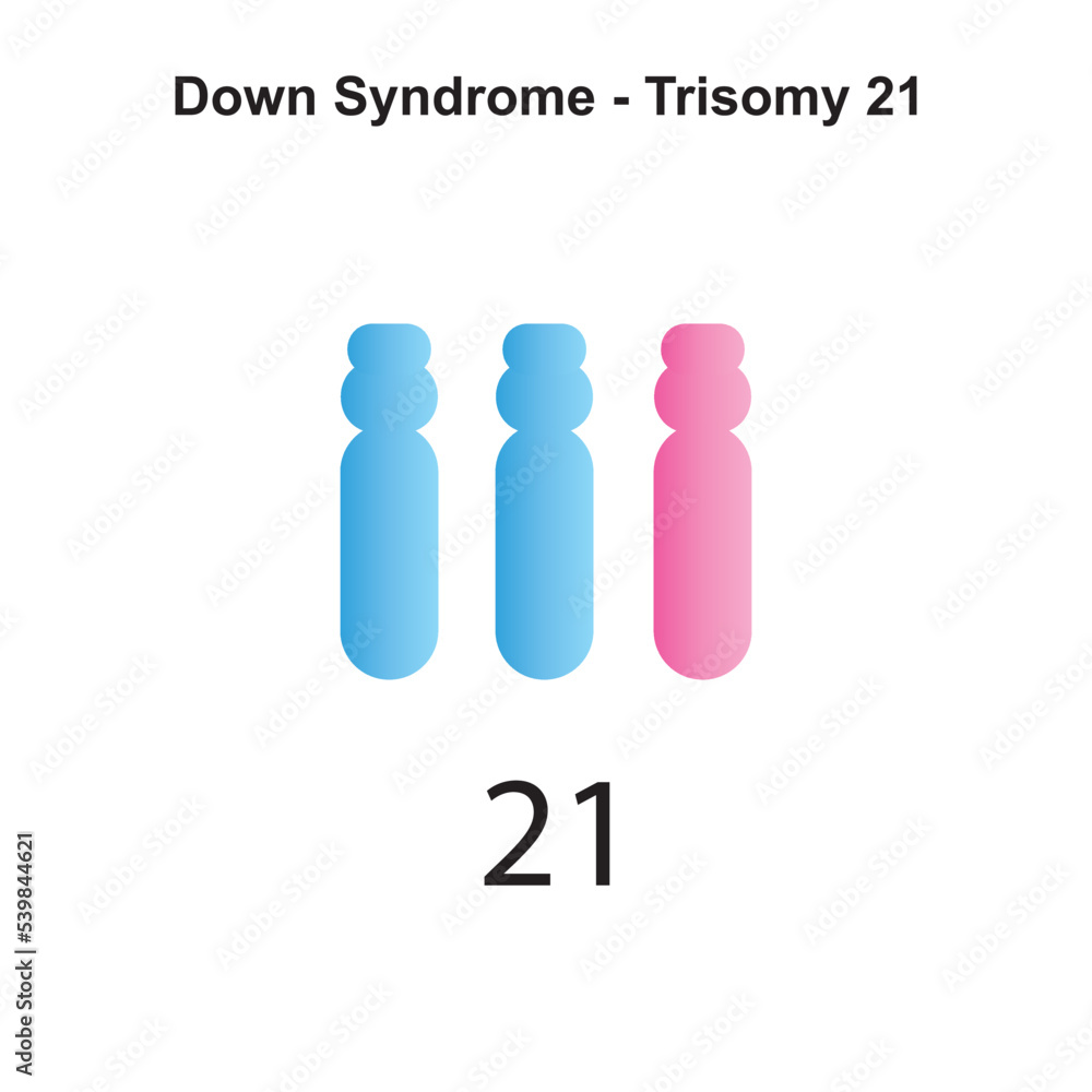 Scientific Designing of Down Syndrome (Trisomy 21). Colorful Symbols ...