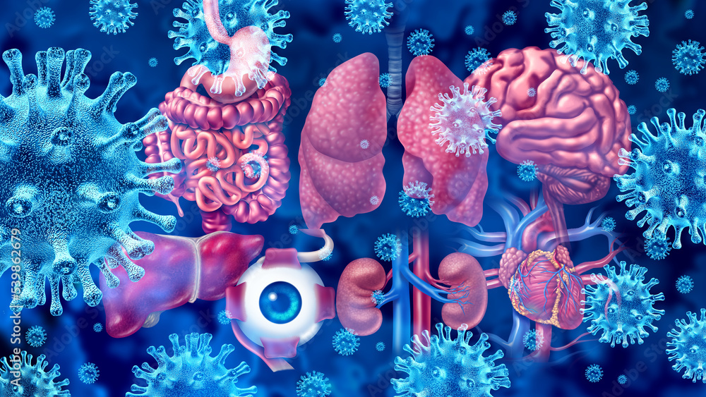 Virus Organ Infection and long Covid syndrome or coronavirus pandemic ...