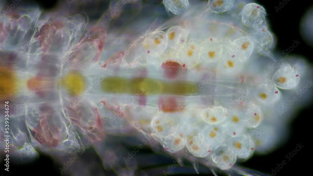 Copepoda Harpacticoida under the microscope. Class Hexanauplia. Female ...