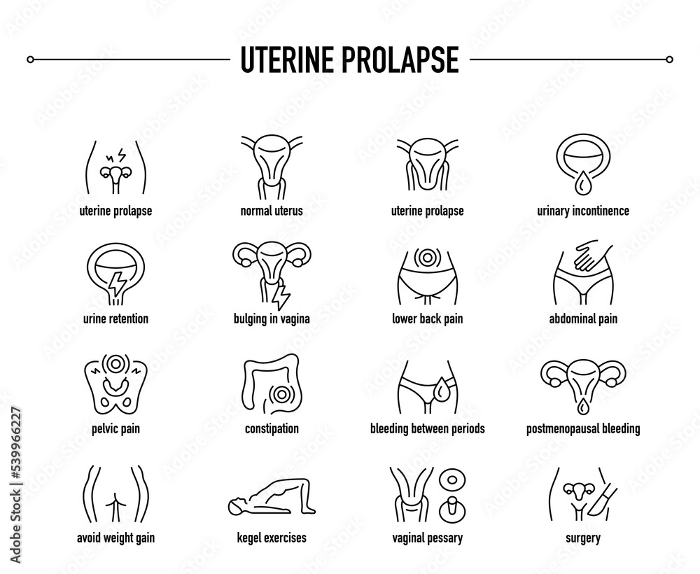 Uterine Prolapse Vector Icon Set Line Editable Medical Icons Stock Vector Adobe Stock