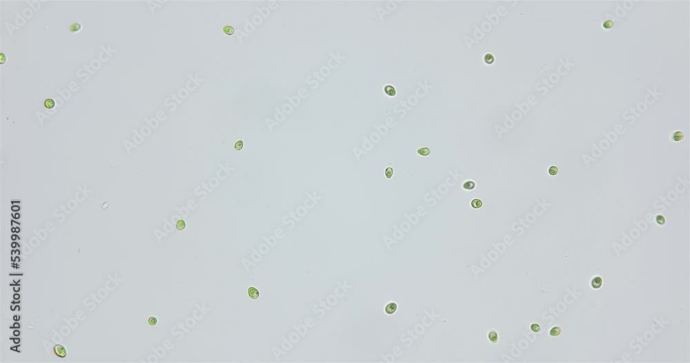 Algae Nannochloropsis under the microscope, Ochrophyta phylum ...