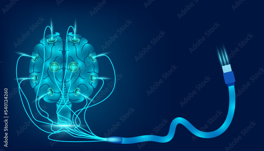 Cartoon drawing of a brain with transcranial magnetic stimulation Stock ...