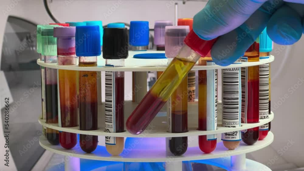 A centrifuge machine has just centrifuged tubes with blood samples for ...