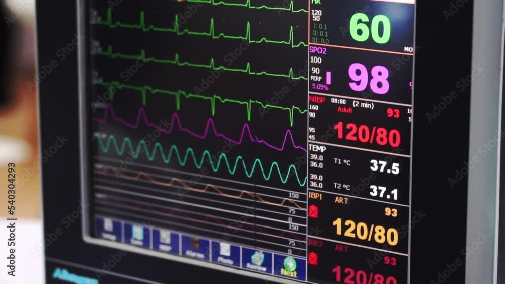 Patient monitor displays vital signs ECG electrocardiogram EKG, body ...