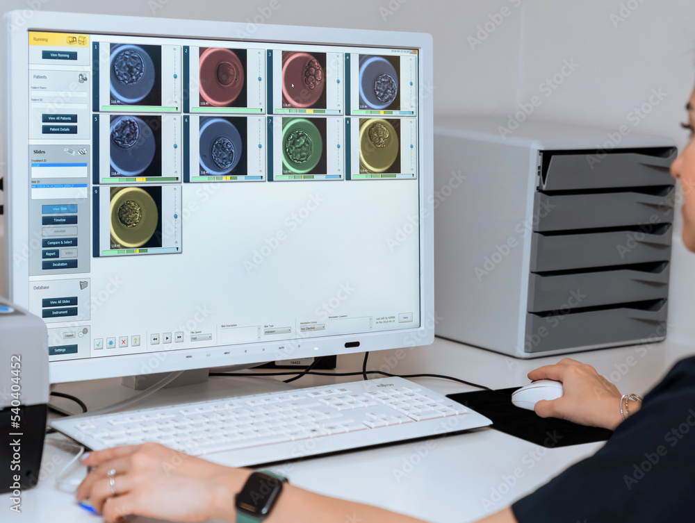 embryologist inserts fertilized egg into embryoscope. EmbryoScope for ...