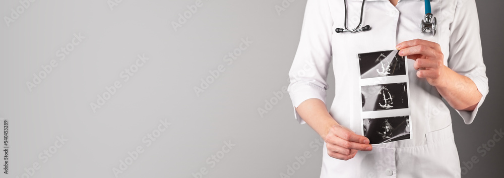 Heart ultrasound, cardiac scan, medical check-up result. Ad banner ...