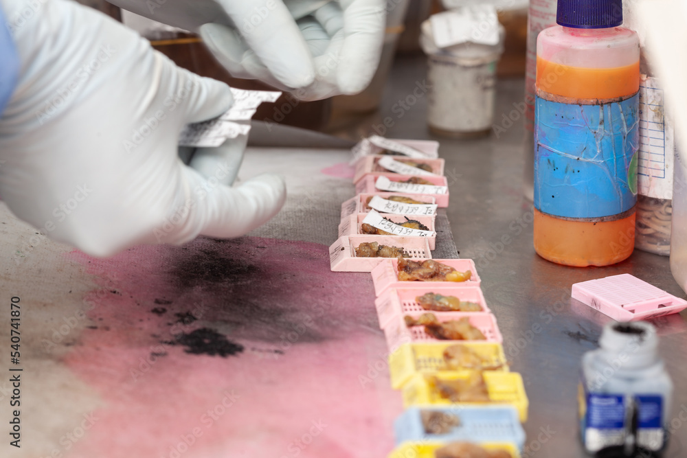Biopsy samples being processed at the pathology laboratory to be ...