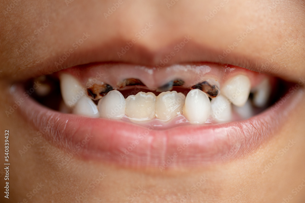 Poster Close Up Toothless Child – Wall Art | UkPosters