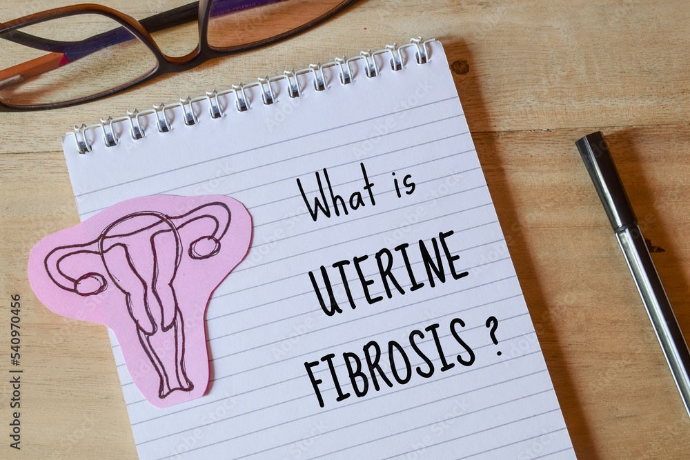 Notepad with the question what is Endometriosis and hand drawn paper ...