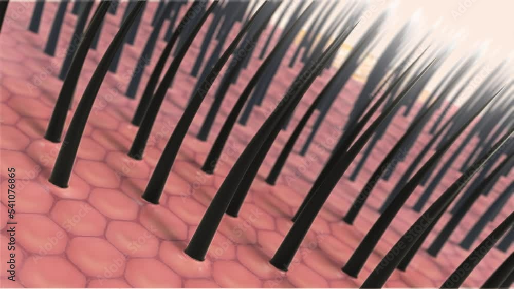 Dandruff hair care. Action of anti-dandruff shampoo on hair and scalp ...