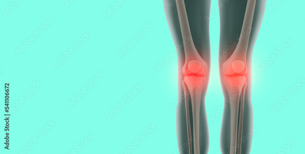Joint pain, arthritis and tendon problems. human knees with ...