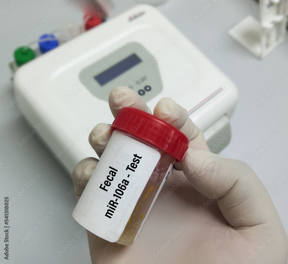 Fecal miR-106a test. Doctor holding fecal sample container with feces ...
